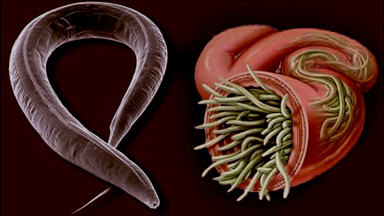 Bağırsak parazit ve kurtlarını dökmenin en hızlı ve en kolay yolu ...